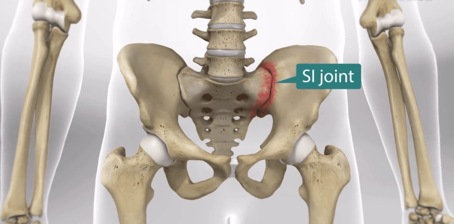 Si Joint Pain Symptoms Treatment Options Florida Surgery Consultants